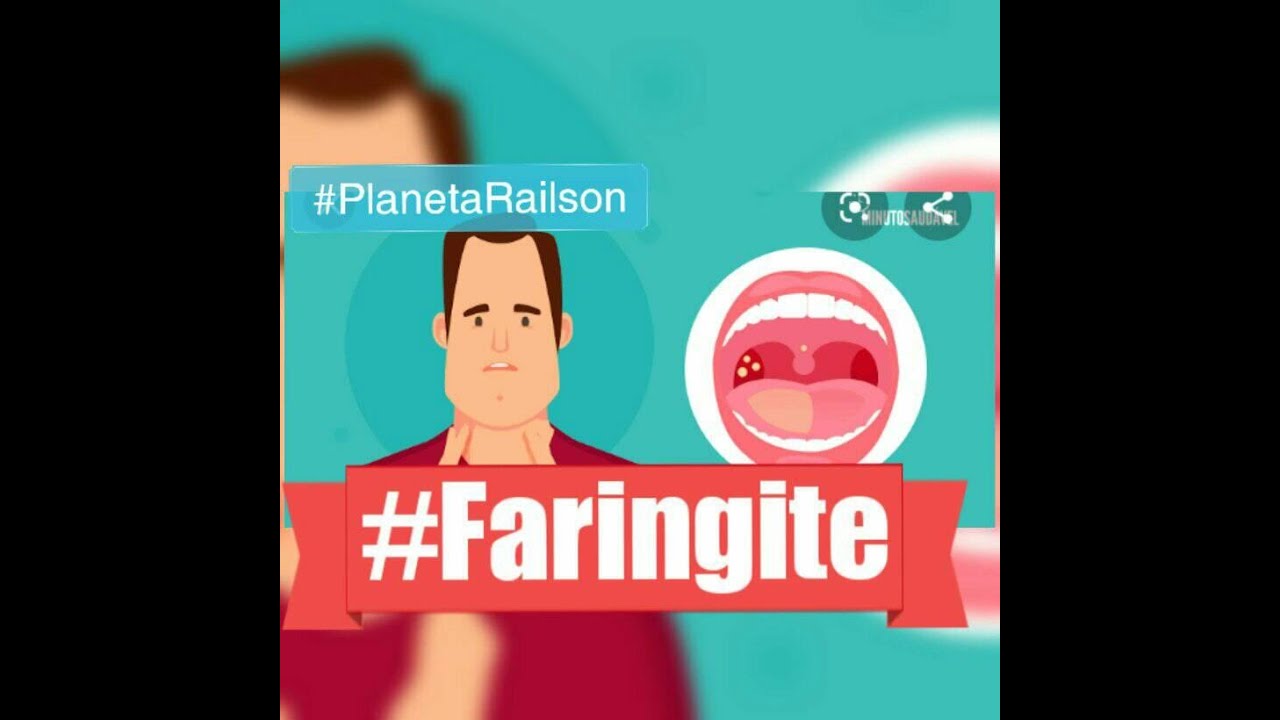 Faringite (Sintomas,Diagnóstico e Tratamento) - Planeta Railson - YouTube