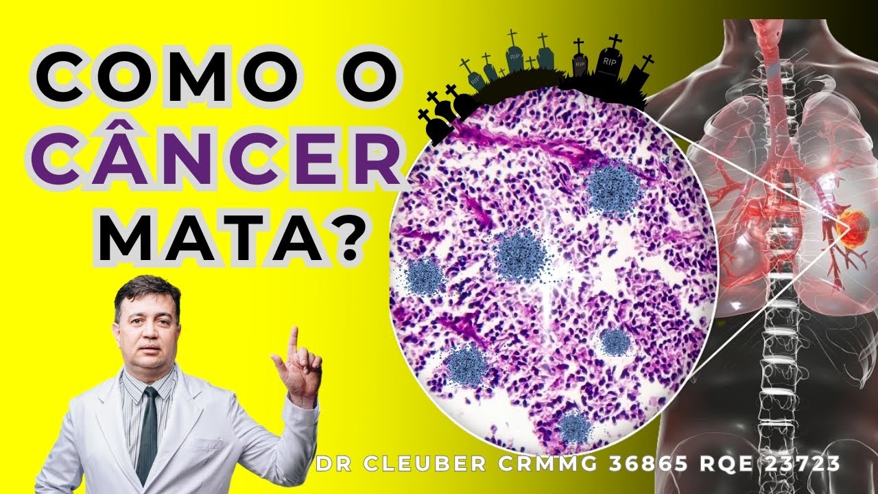 Como o Câncer Mata: Entenda os Mecanismos e Como se Previnir⚰️ - YouTube
