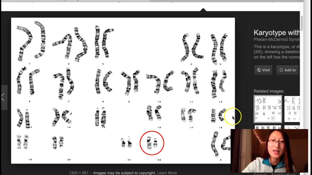 Genetics Lecture 4 Karyotype Review - YouTube