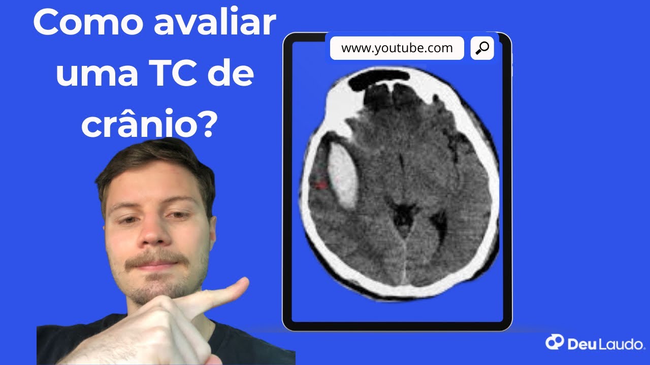 COMO AVALIAR UMA TC DE CRÂNIO - YouTube