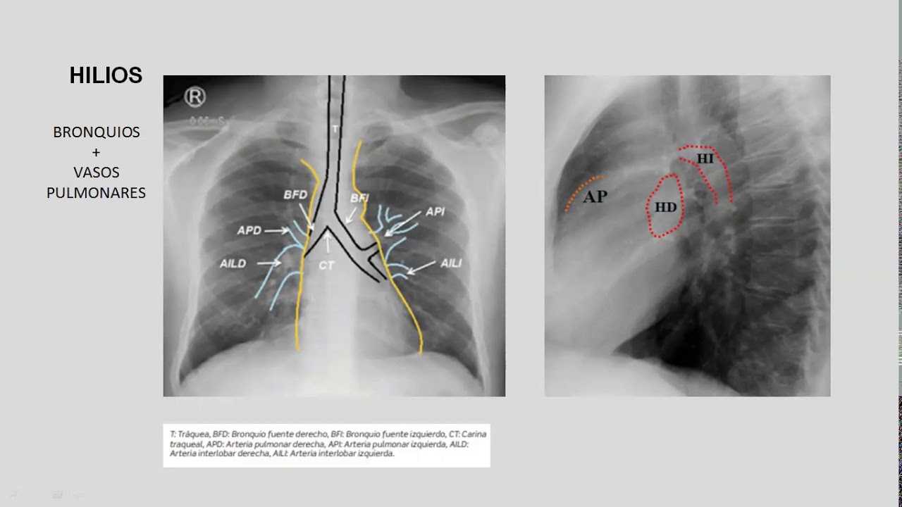 Tórax y Cardiovascular normal - YouTube