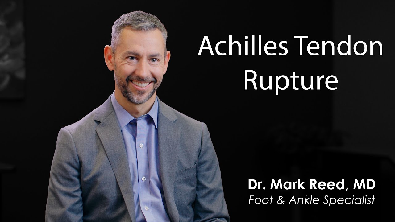 Achilles Tendon Rupture: Diagnosing and Treatment Options | Dr. Mark ...