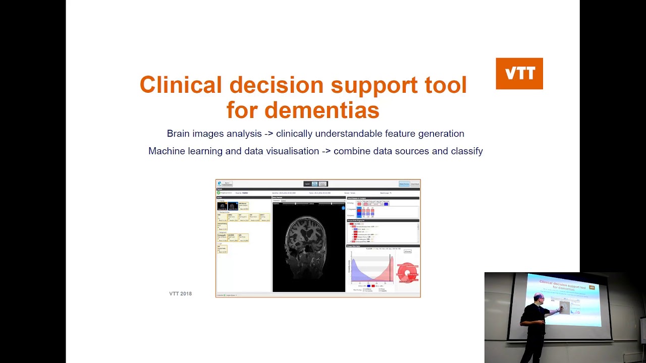 Machine Learning for Clinical Decision Support - How To Make It Work ...