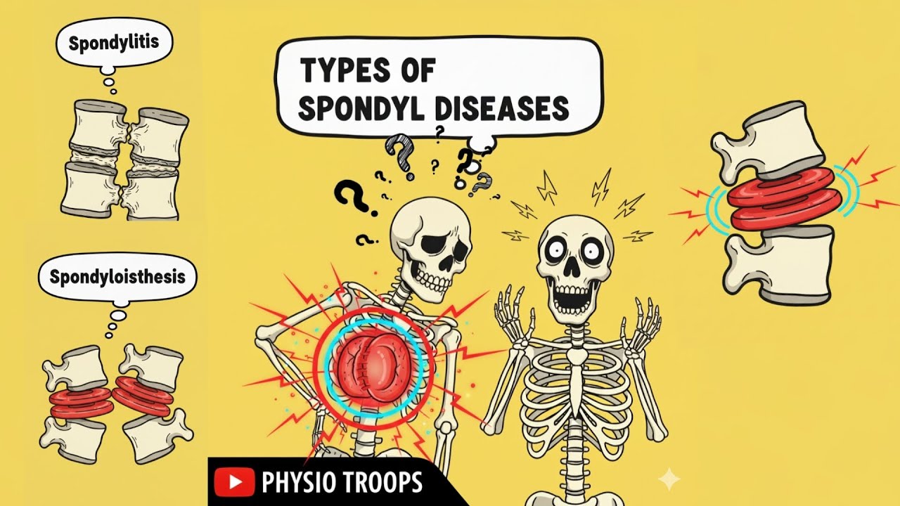"Top 5 Spondyl Diseases You Must Know | Spine Disorders Simplified ...