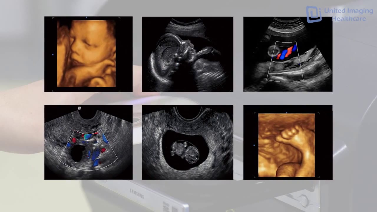 USG 4 DIMENSI iuSTAR - YouTube