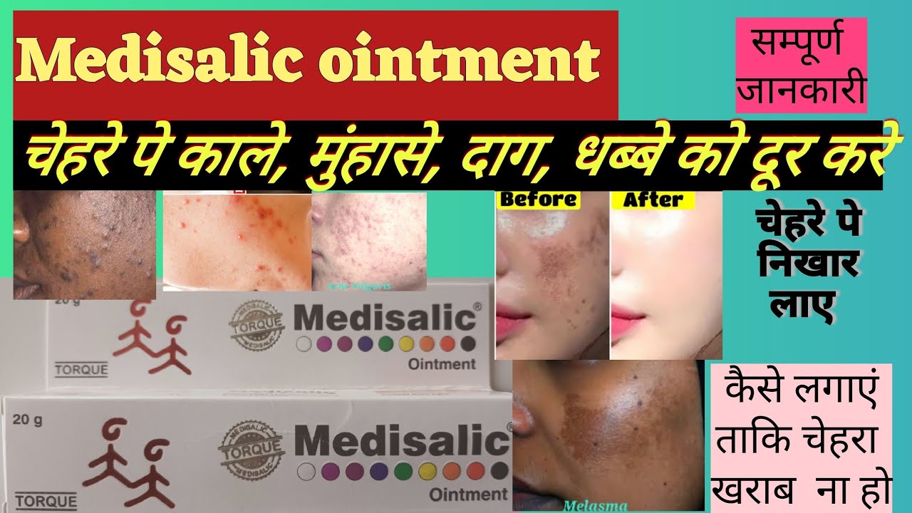 Medisalic ointment, cream uses, side effects, - YouTube