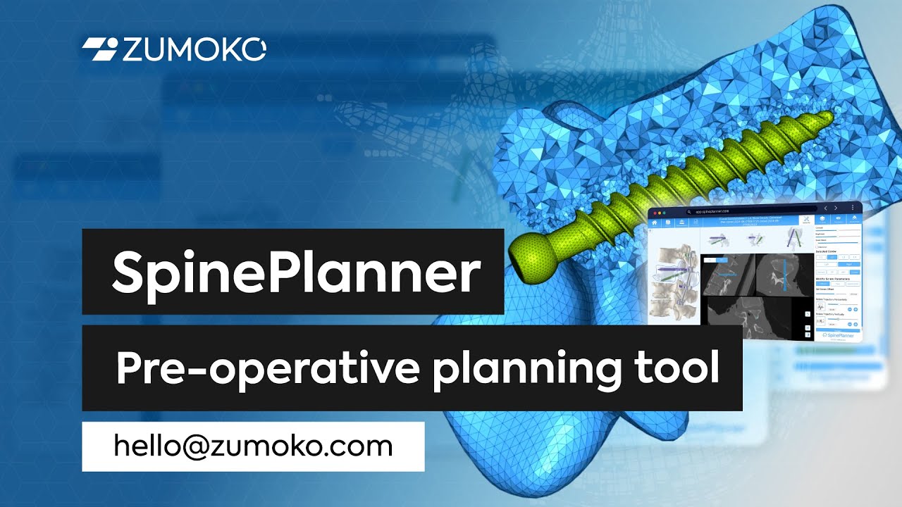 SpinePlanner: Pre-operative planning tool - YouTube