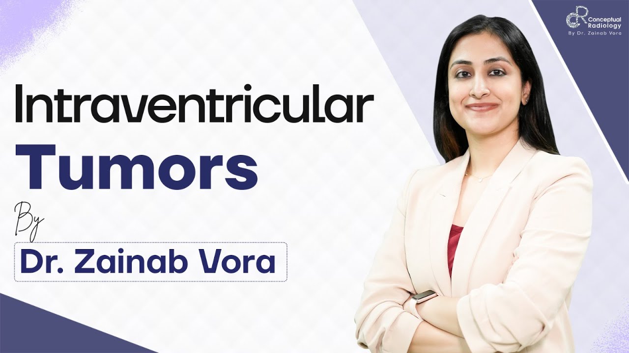 Intraventricular Tumors by Dr. Zainab Vora - YouTube