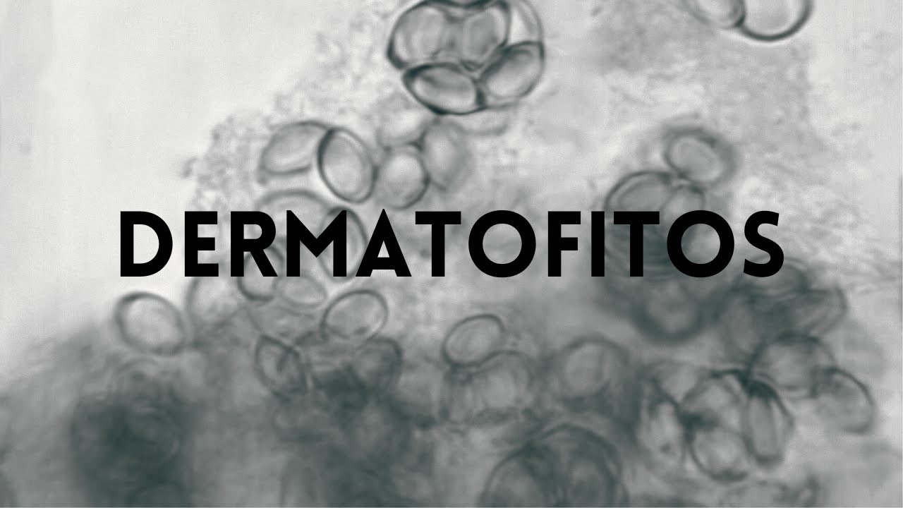 Dermatofitos | Hongos | Micologia | MICRO CON LUA - YouTube