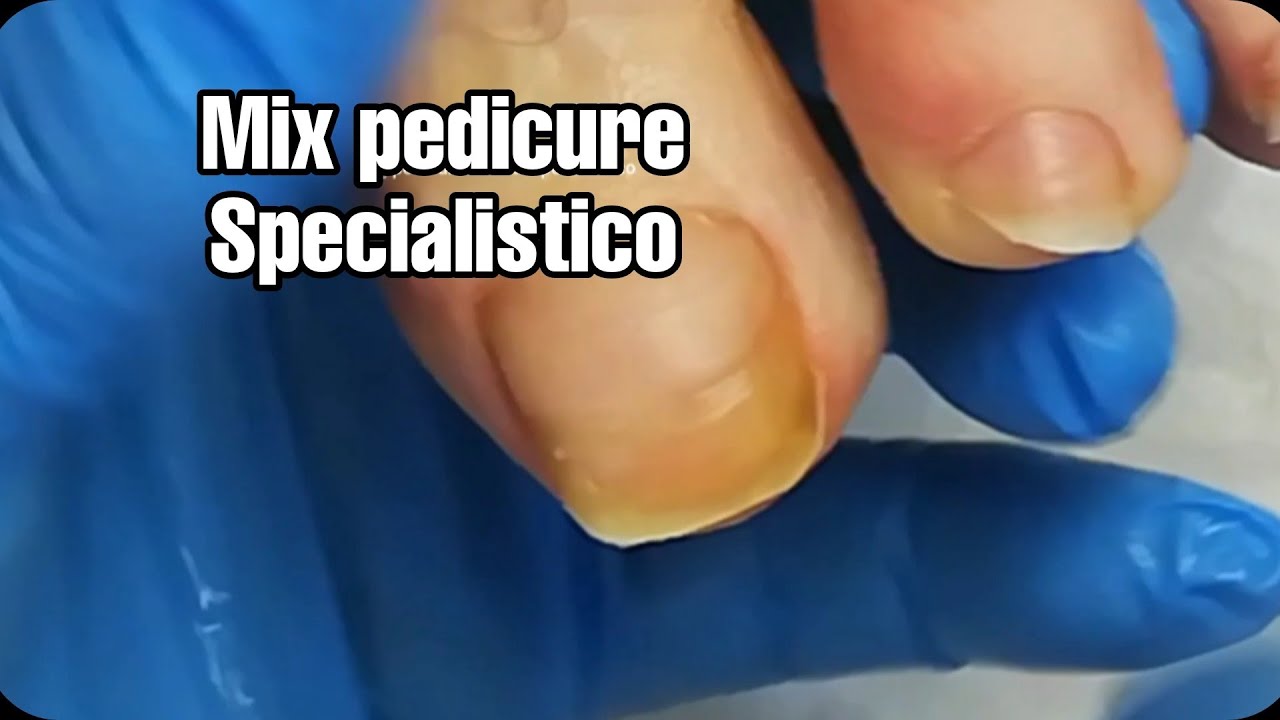 Mix pedicure specialistico #unghie #ispessite - YouTube