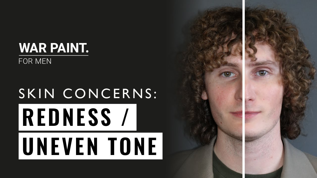 TACKLING COMMON SKIN CONCERNS | REDNESS & UNEVEN TONE - YouTube