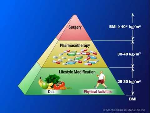 Current Management of Obesity - YouTube