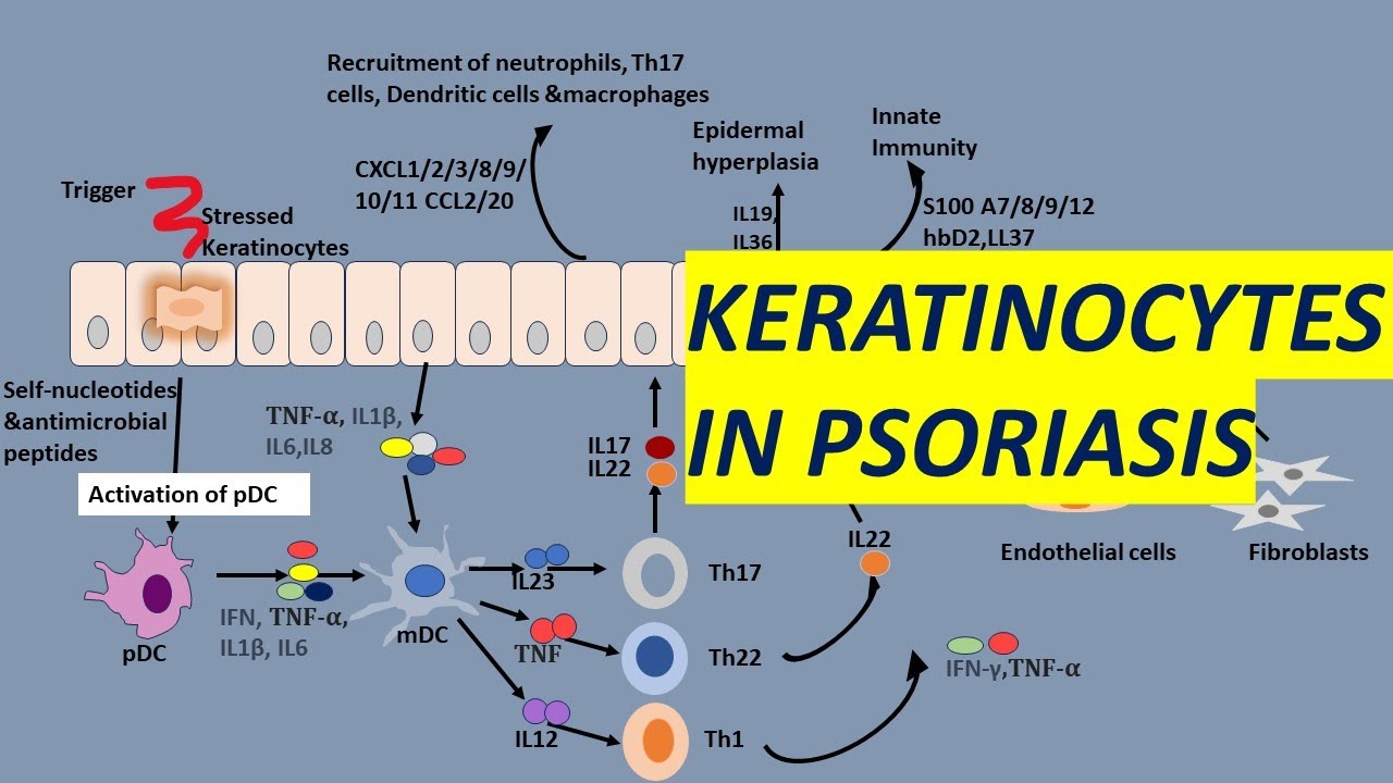 Dr Naglaa Elmongy//Psoriasis Pathogenesis: Presenting the Key Role of ...