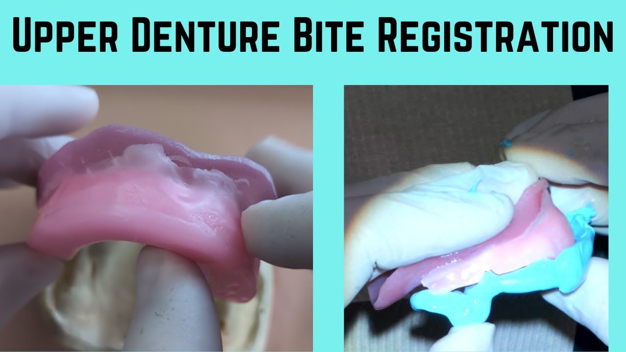Denture Bite registration - YouTube