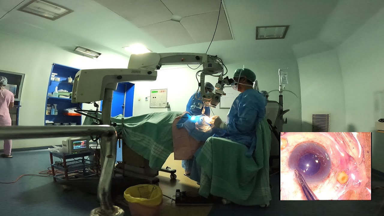How is retinal surgery done? | MIVS 23 G Vitrectomy for Diabetic Bleed ...