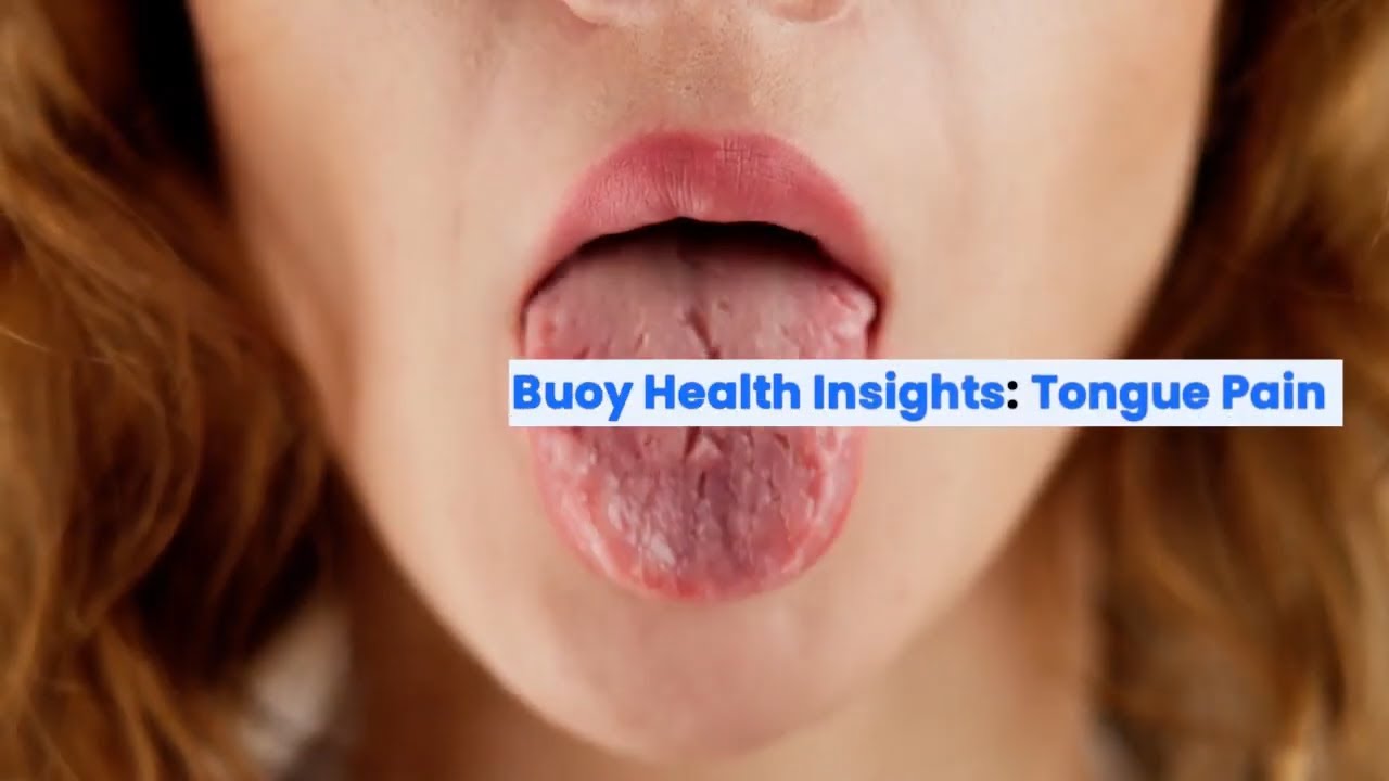 Tongue Pain Common Causes And When To Seek Medical Care BuoyHealth tongue-pain-common-causes-and-when-to-seek-medical-care-buoyhealth