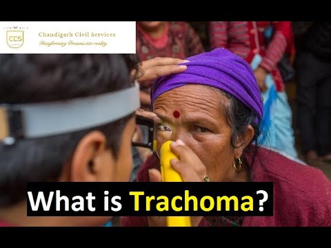 What is Trachoma? | SAFE Strategy | - YouTube