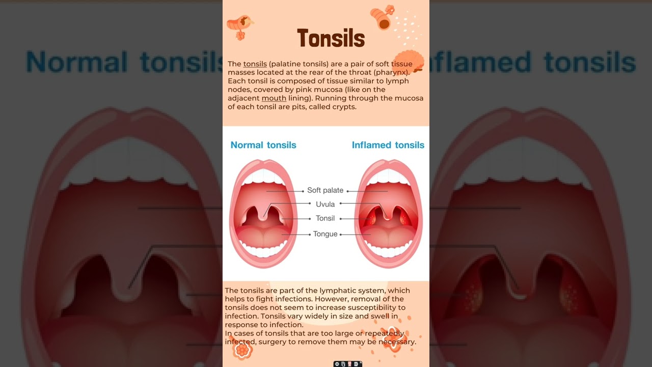 Tonsils - YouTube