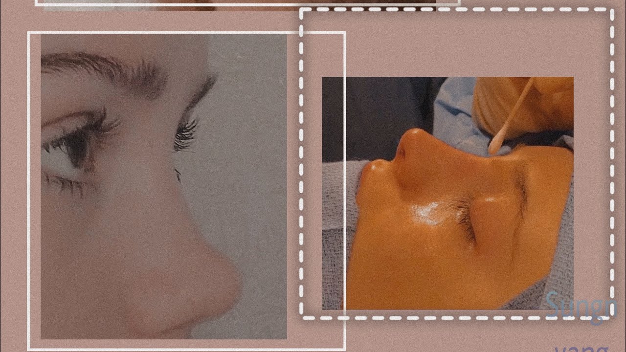 𝐏𝐞𝐫𝐟𝐞𝐜𝐭 𝐧𝐨𝐬𝐞★- 𝐒𝐮𝐛𝐥𝐢𝐦𝐢𝐧𝐚𝐥 - YouTube