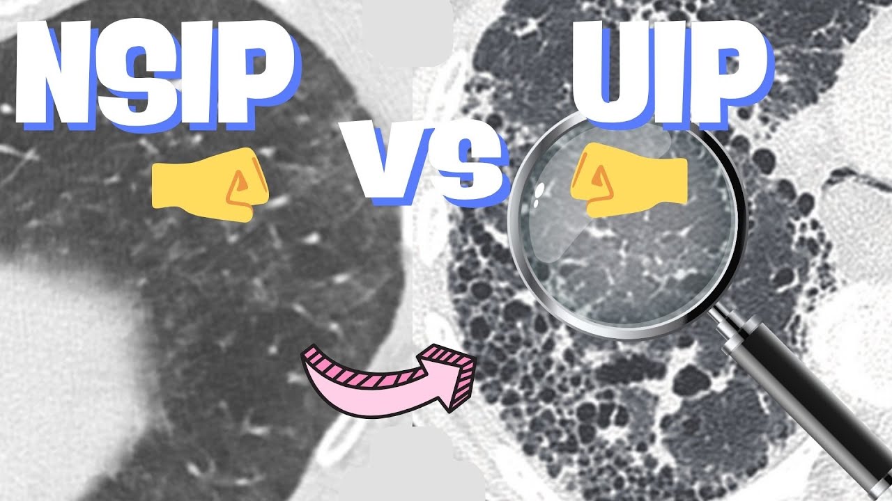 📌9 TRUCOS para identificar la NSIP 👀 - YouTube