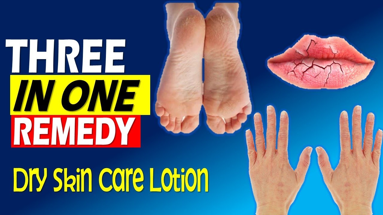 Dry Skin Care, Chapped Lips, Cracked Heels, Rough Hands - YouTube