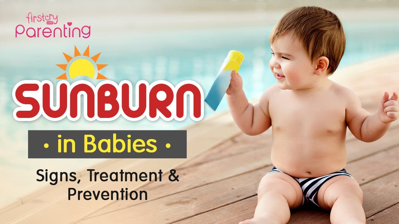Easy Tips Precautions For Baby Sunburn YouTube easy-tips-precautions-for-baby-sunburn-youtube