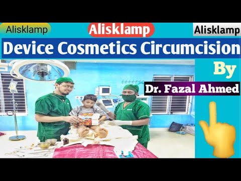 Alisklamp Device Cosmetic Circumcision - YouTube
