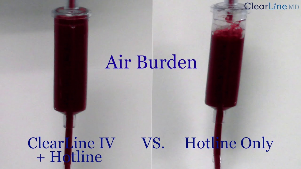 Air Burden - the ClearLine IV Difference with Hotline Fluid Warmer ...