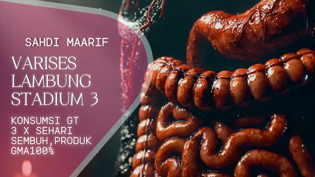 🔴 VARISES LAMBUNG STADUIM 3 - SAHDI MAARIF - GT SOLUSINYA - YouTube