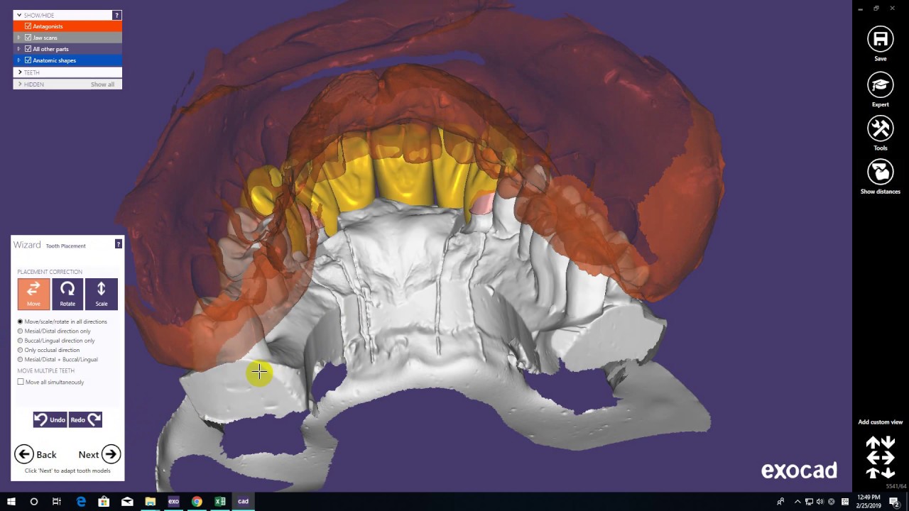 Exocad Design Bridge copping , bridge full incisors - YouTube