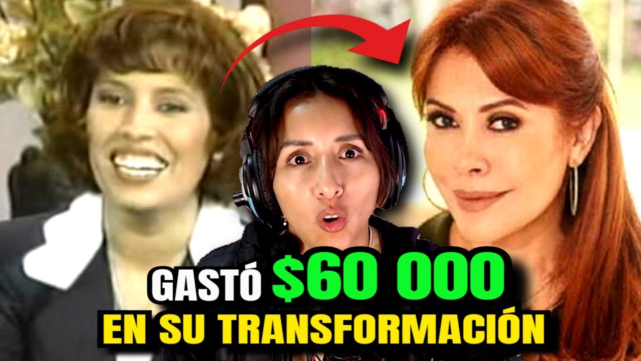 🔥El ANTES y DESPUÉS de MAGALY //Se REVELAN todas las OPERACIONES que se ...