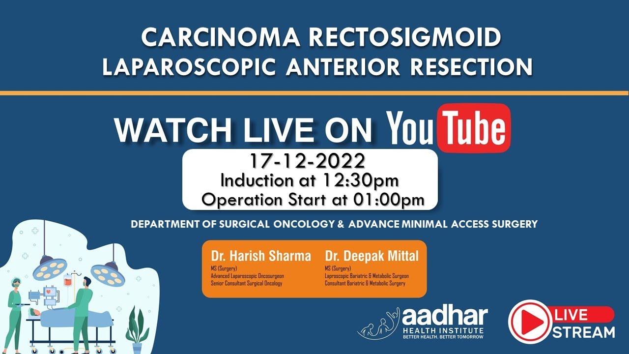 CARCINOMA RECTOSIGMOID LAPAROSCOPIC ANTERIOR RESECTION - YouTube