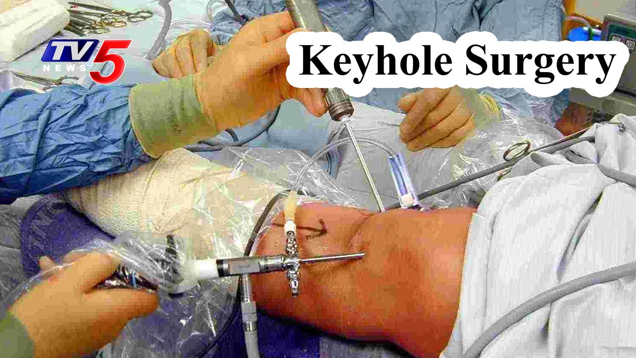What Is The Use Of Keyhole Surgery ? | Knee Replacement | Health File ...