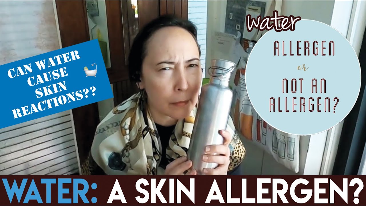 Is My Skin Allergic to WATER?? Is it an Allergen, or Not An Allergen ...