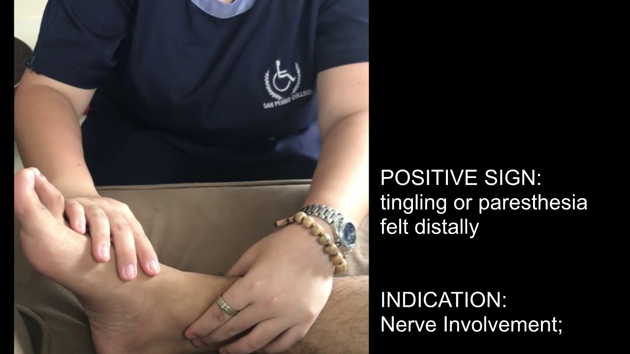 Tinel's Sign at the Ankle (Percussion Sign) - YouTube