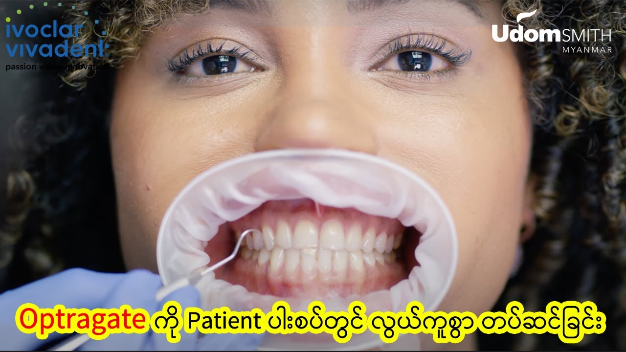 Ivoclar Vivadent- Easy Placement of OptraGate - YouTube