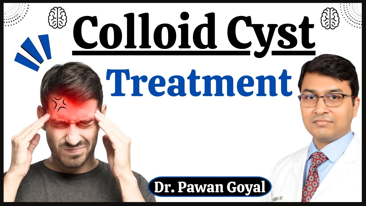 Colloid cyst- treatment | Dr. Pawan Goyal - YouTube