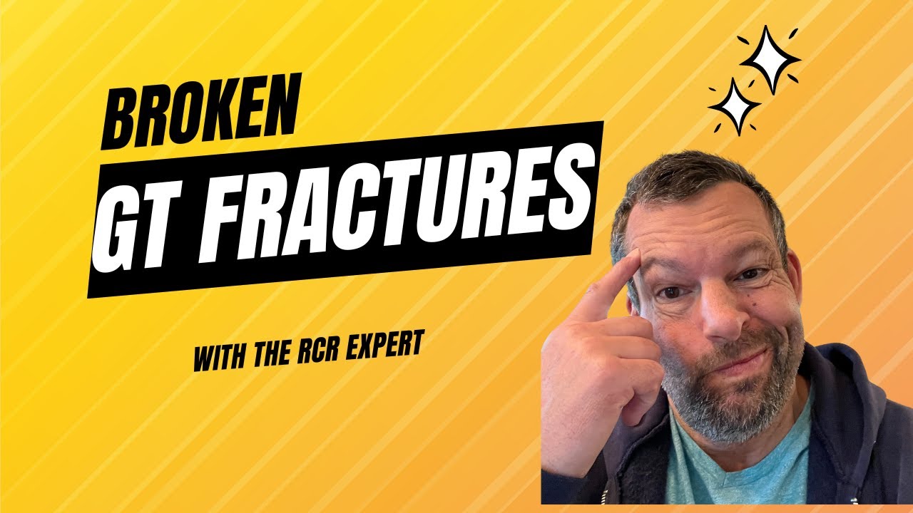 Busted Shoulder: Everything You Need To Know About Greater Tuberosity ...