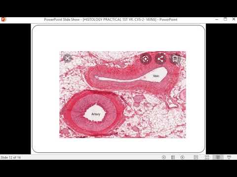 HISTOLOGY PRACTICAL CVS- 2, VEINS. 1st year MBBS - YouTube