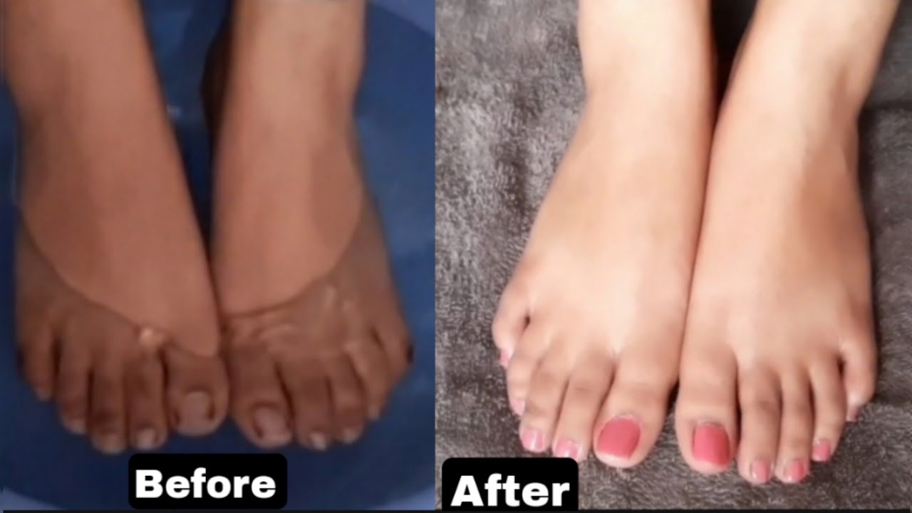 Feet Whitening Pedicure At Home ||Remove tan and feet whitening ...
