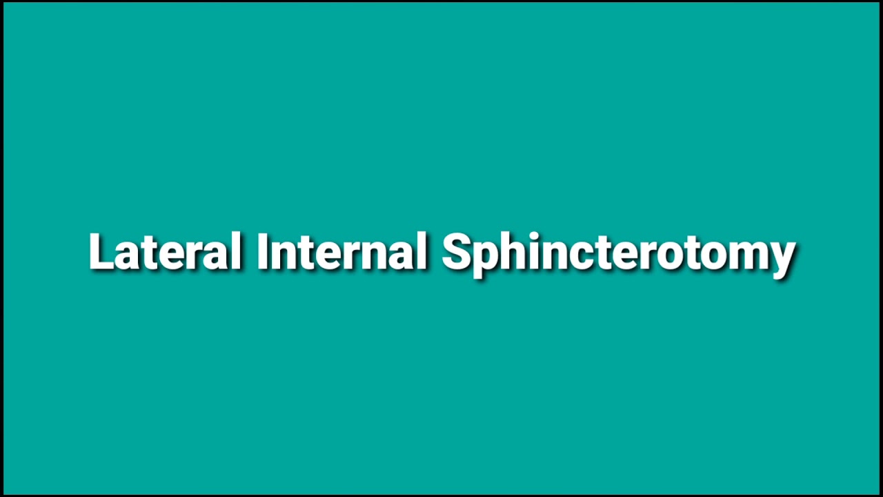 LIS | LATERAL INTERNAL SPHINCTEROTOMY | SURGERY| PROCTOLOGY | - YouTube