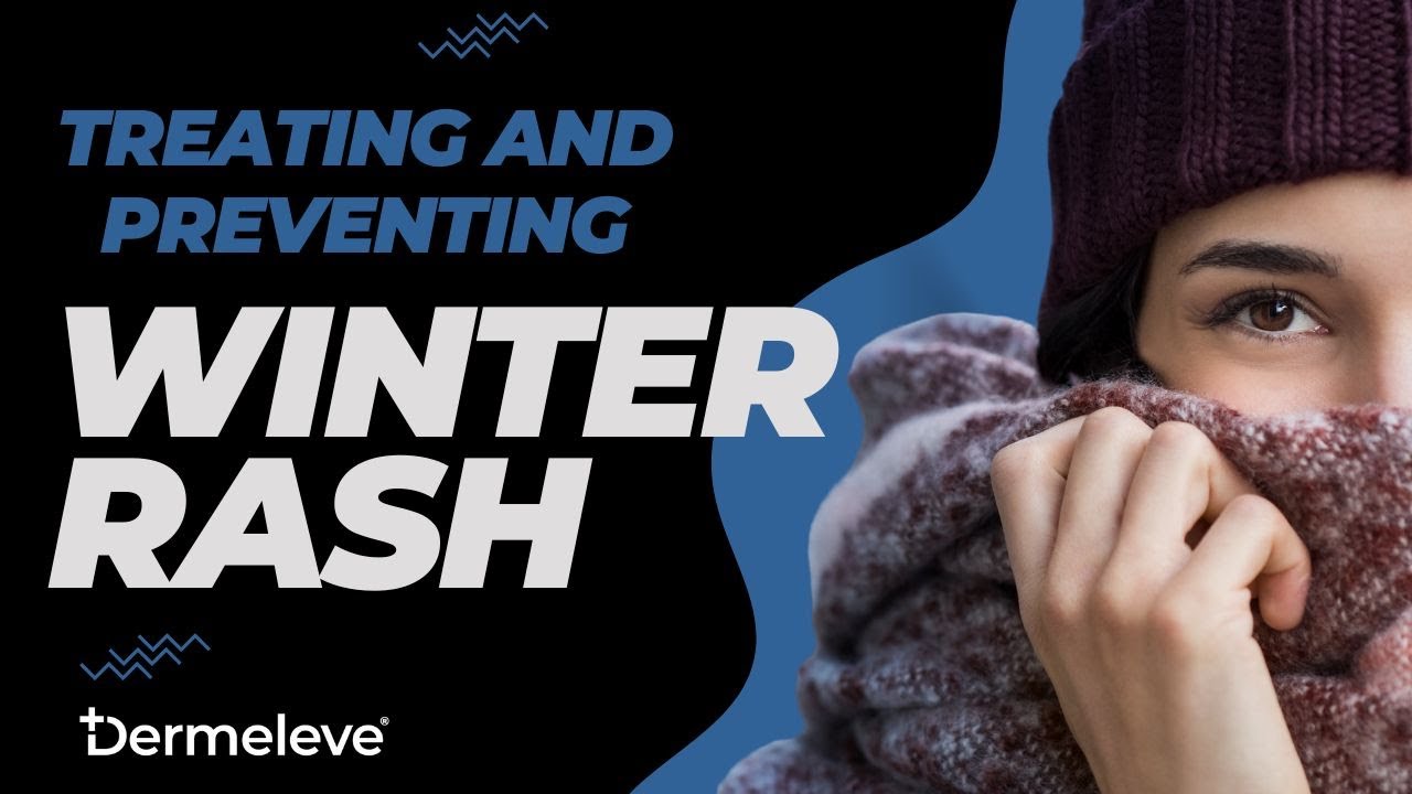 Treating and Preventing Winter Bumps and Rash on Your Hands - YouTube