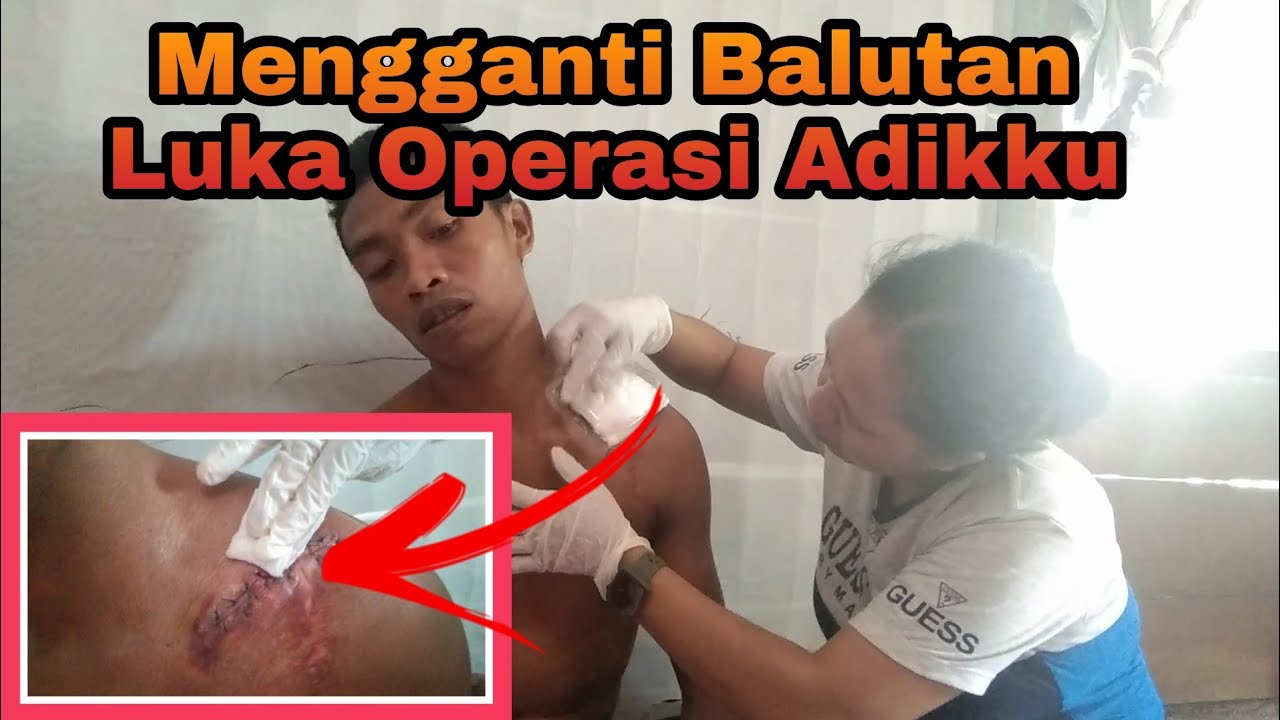 Mengganti Balutan Luka Operasi Adikku@nersjeci731 - YouTube