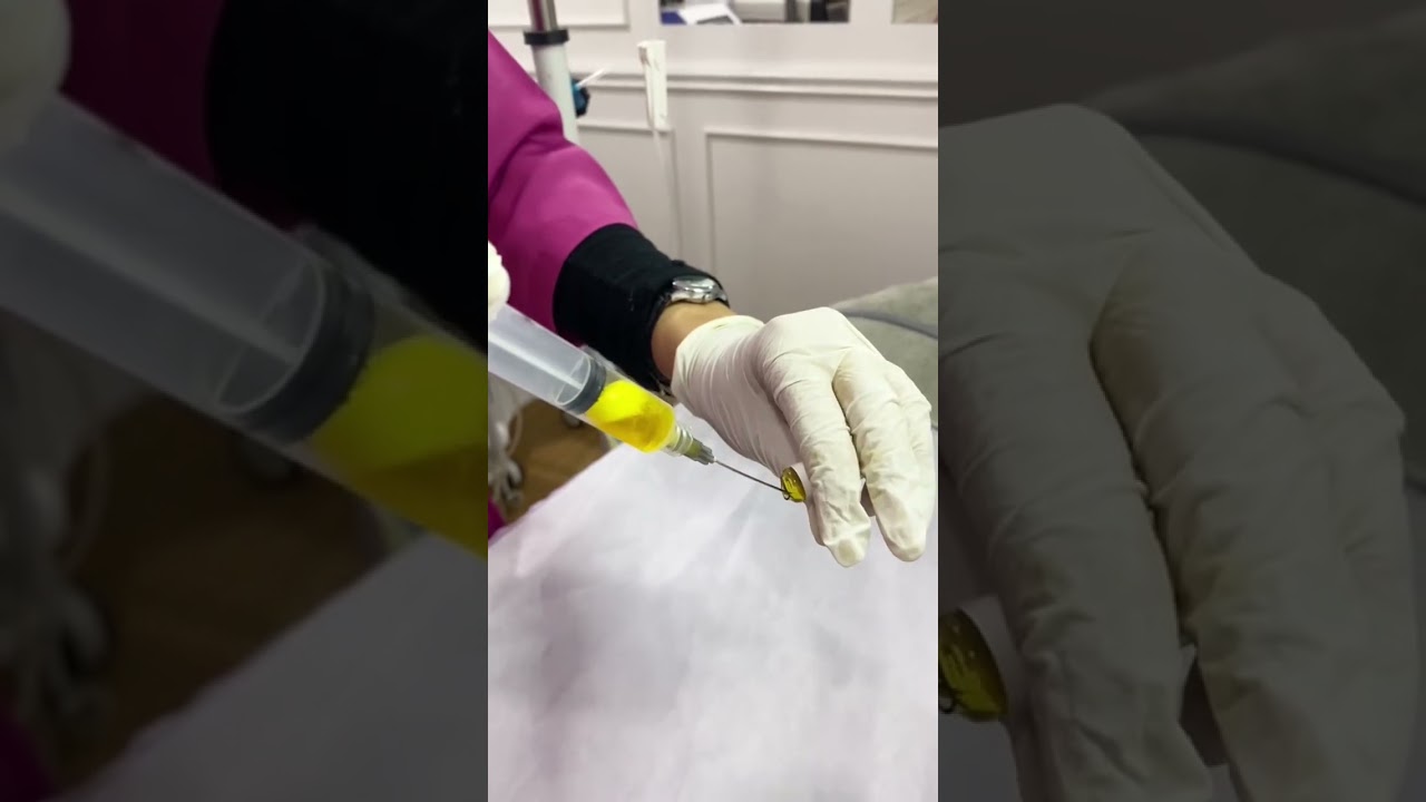 Infus Whitening nadifaclinic - YouTube