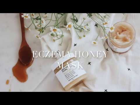 Jessica Windle - Eczema Honey Co. Product Review! - YouTube