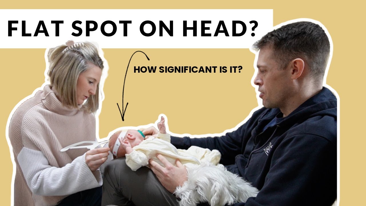 Baby Head Shapes: What To Do If You See A Flat Spot On Your Baby's Head ...