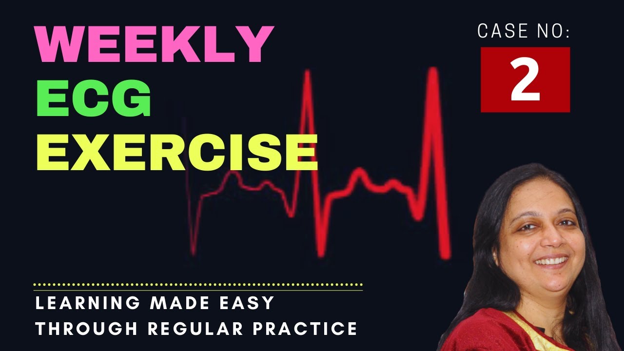Weekly ECG exercise Case 2 - YouTube