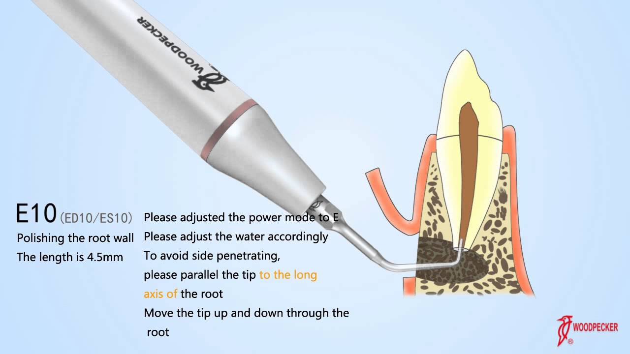 WOODPECKER TIP-E10/E10D - YouTube