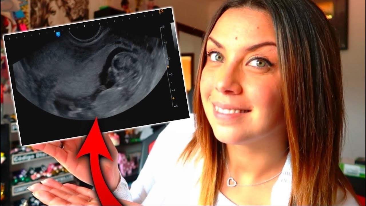 YA SABEMOS EL S3X0 DEL BEBE!!! patty dragona - YouTube