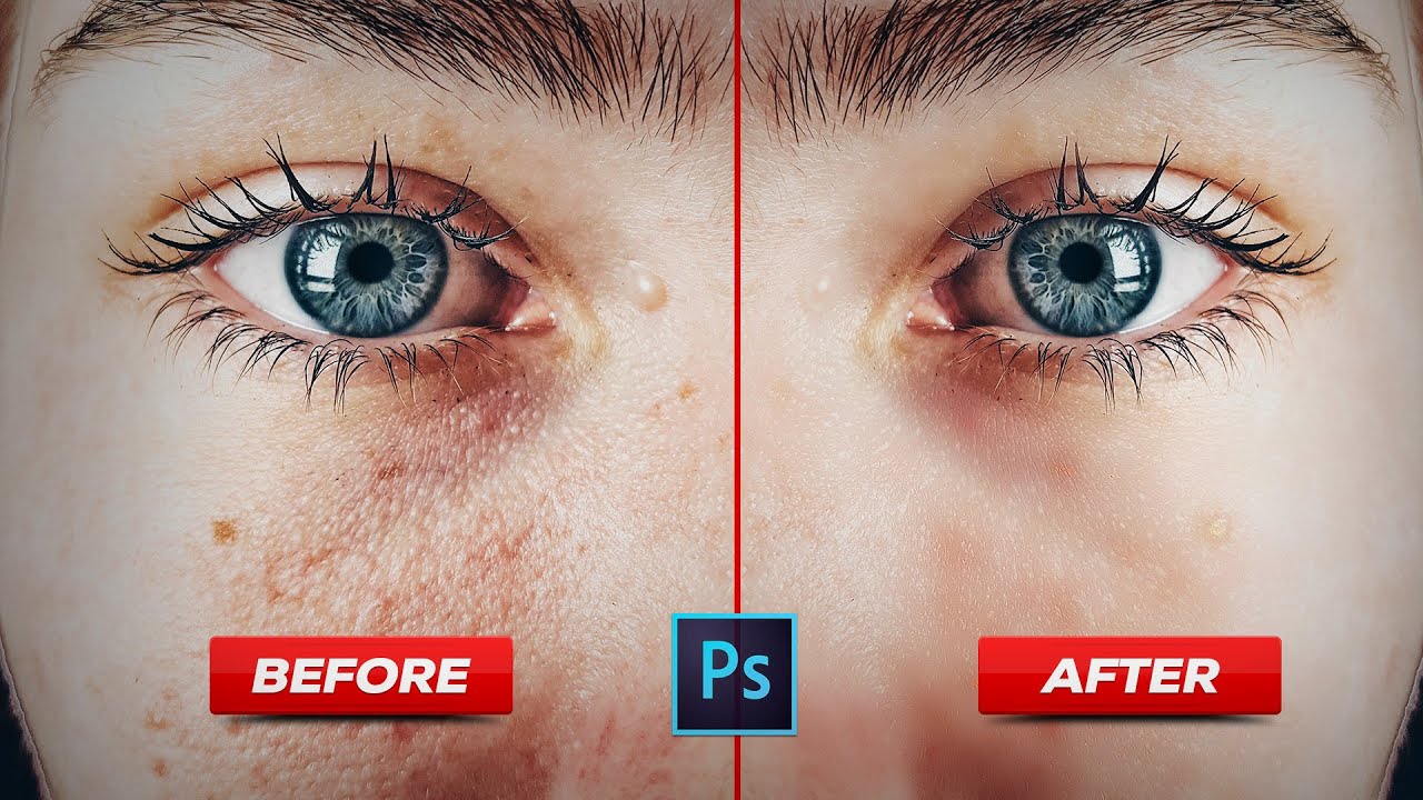 ERASE Blotchy Skin with High-End Retouching Trick! - Photoshop Tutorial ...